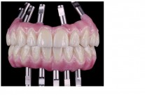 RX Forms - B and M Dental Lab
